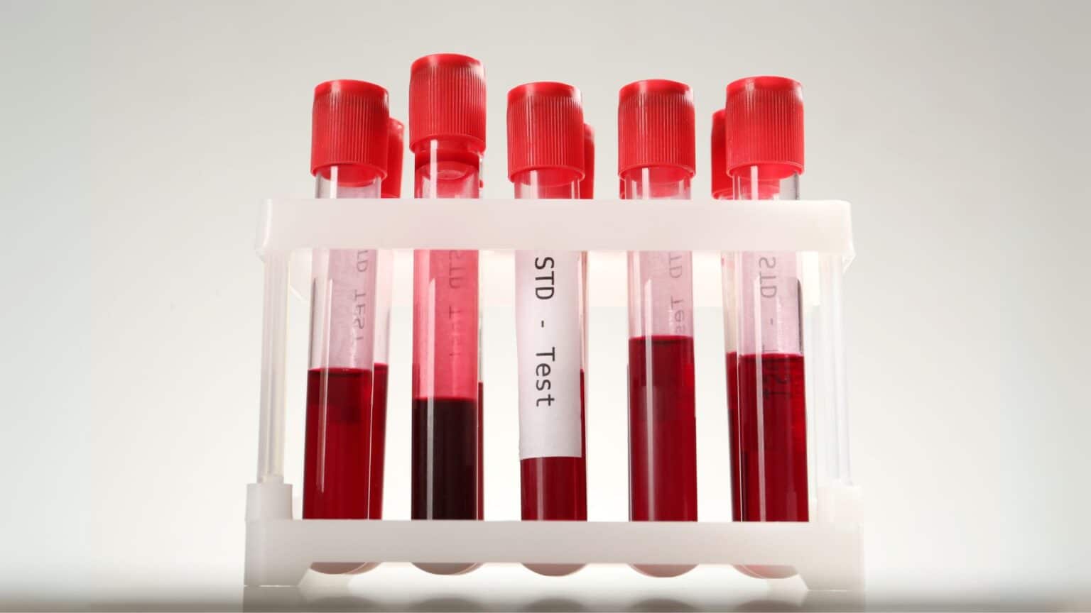 5 Reasons to Get Tested for STDs Every Year | STD Test Bangkok