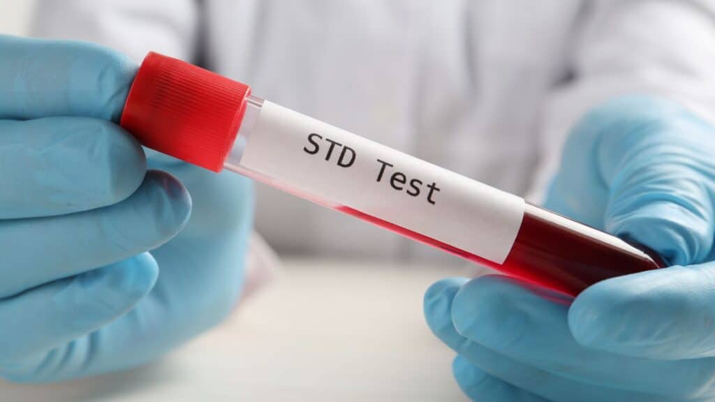Do You Need an STD Test with No Symptoms? Here’s Why